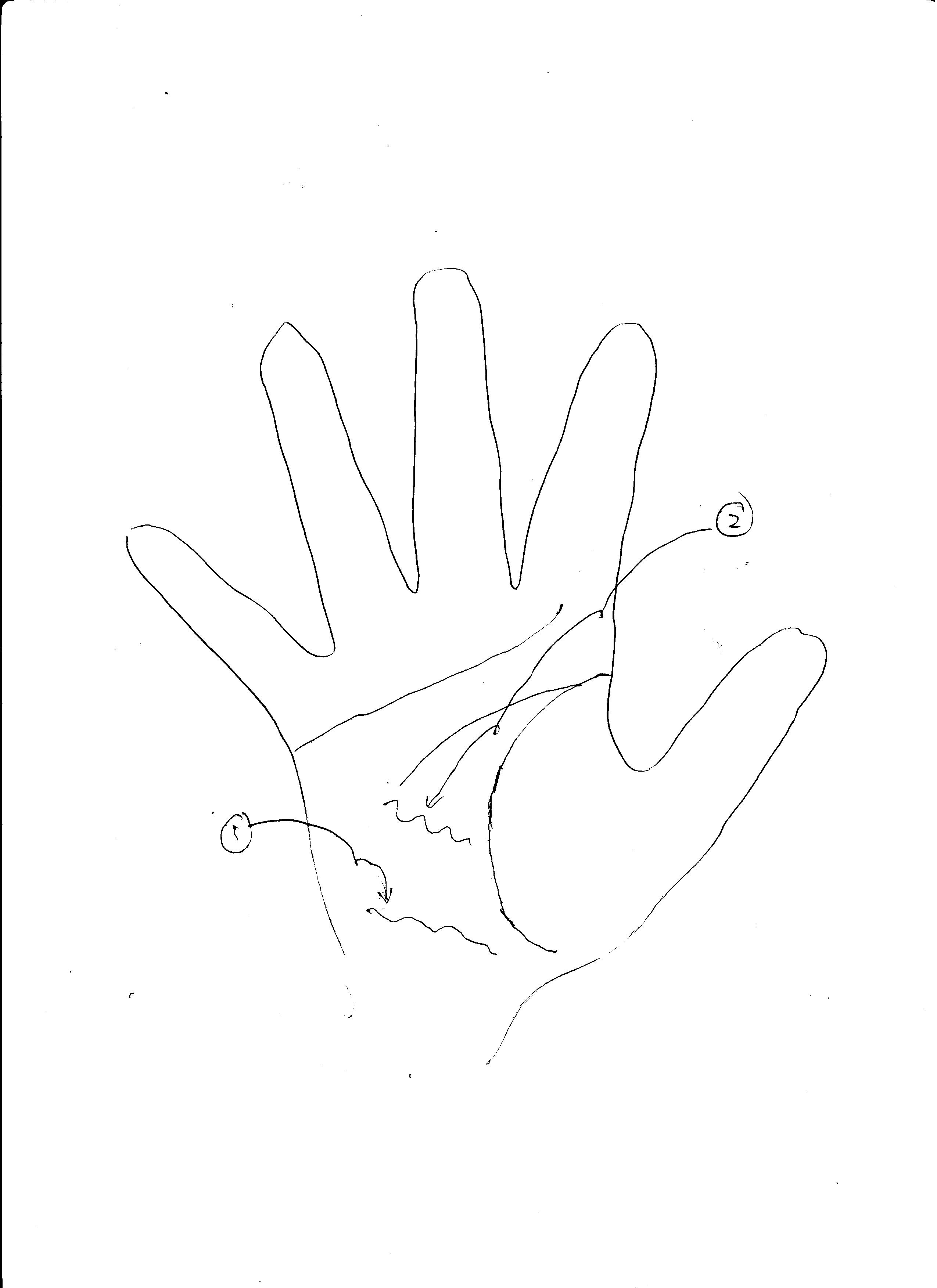 The Palm Pattern shows the Problems of the Liver and the Kidney ...
