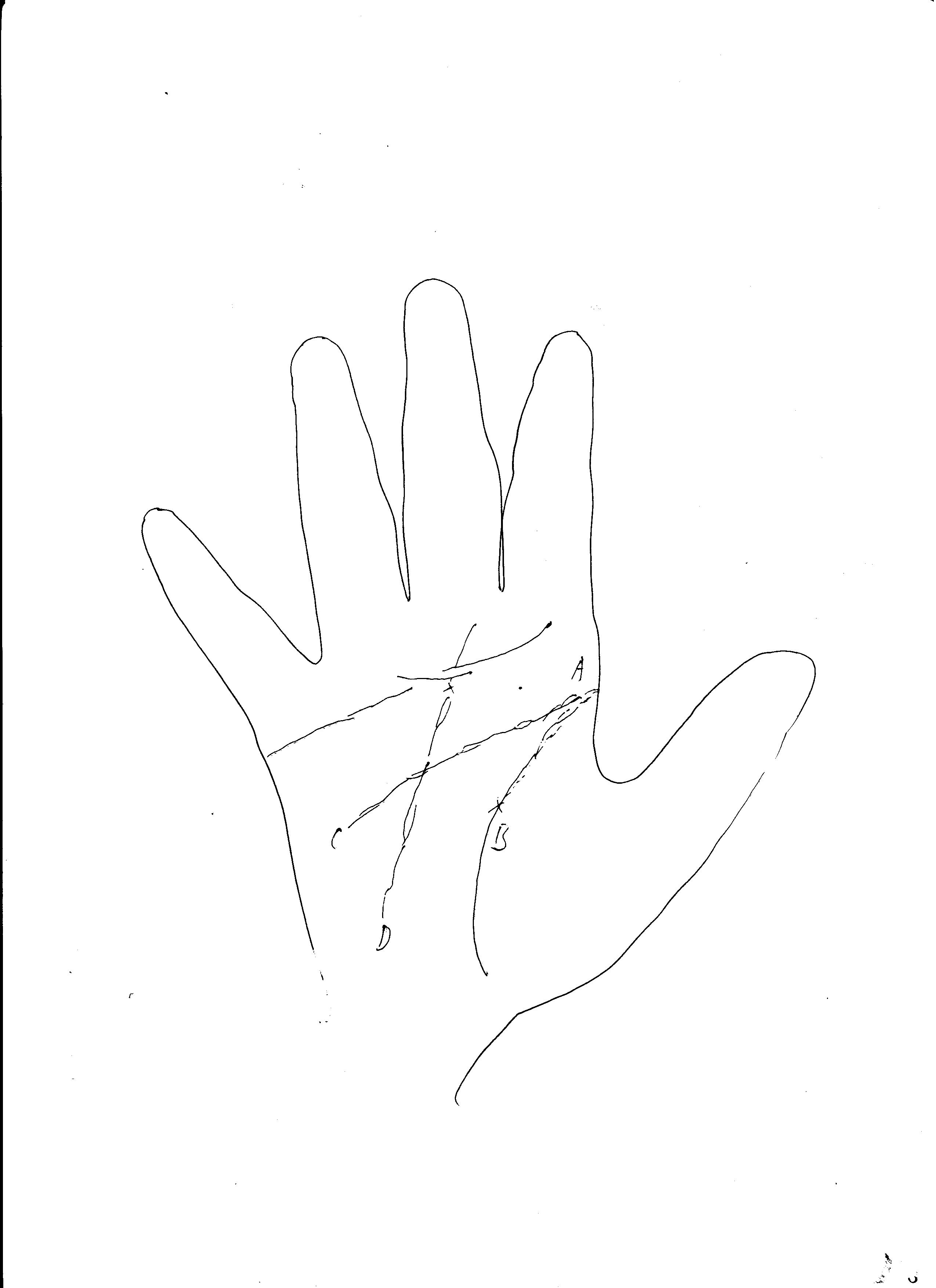 Palm Pattern that the Owner is easy to get sick – Palmist's blog