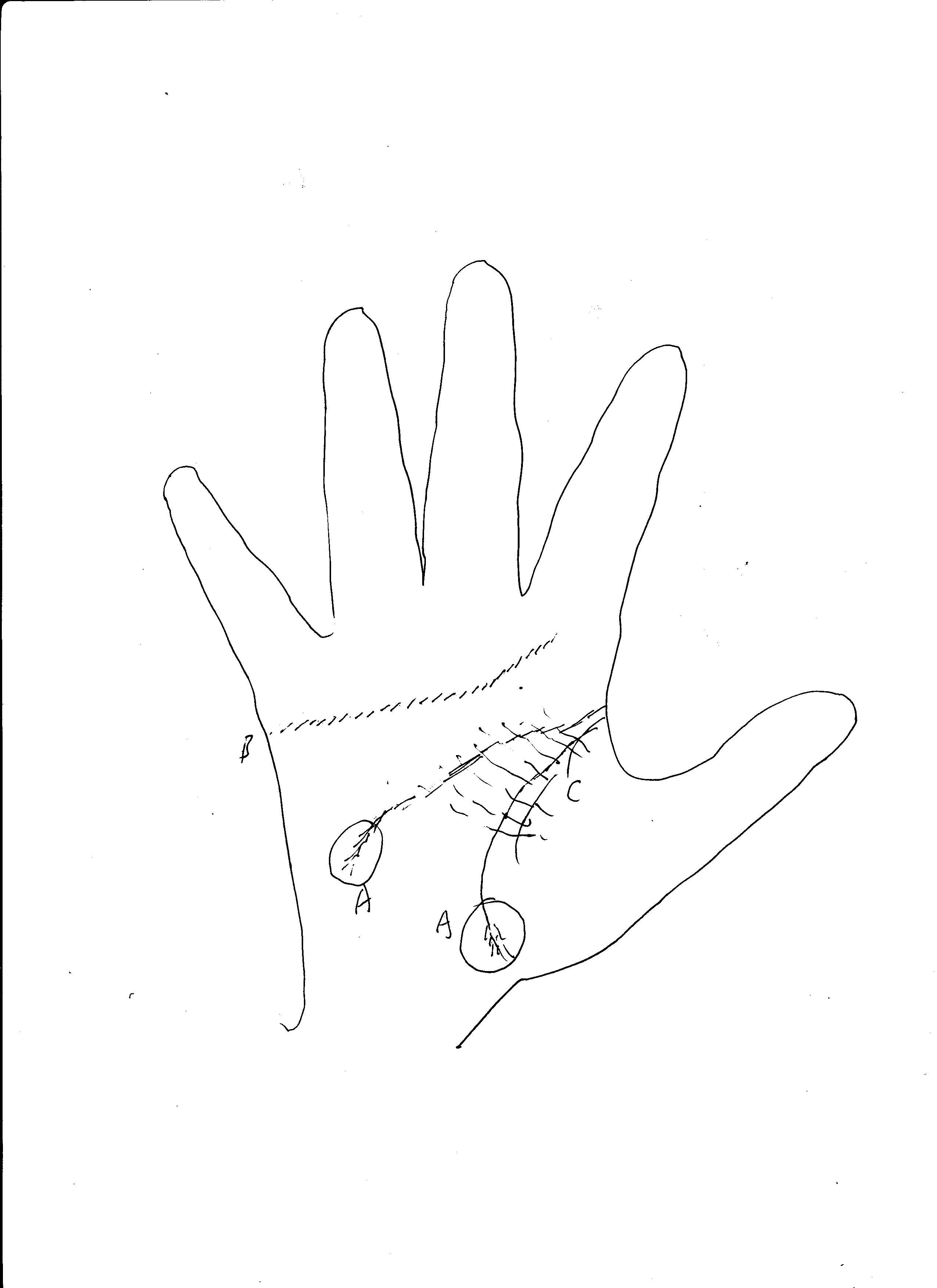 Palm Pattern that the Owner quickly gets Sick – Palmist's blog