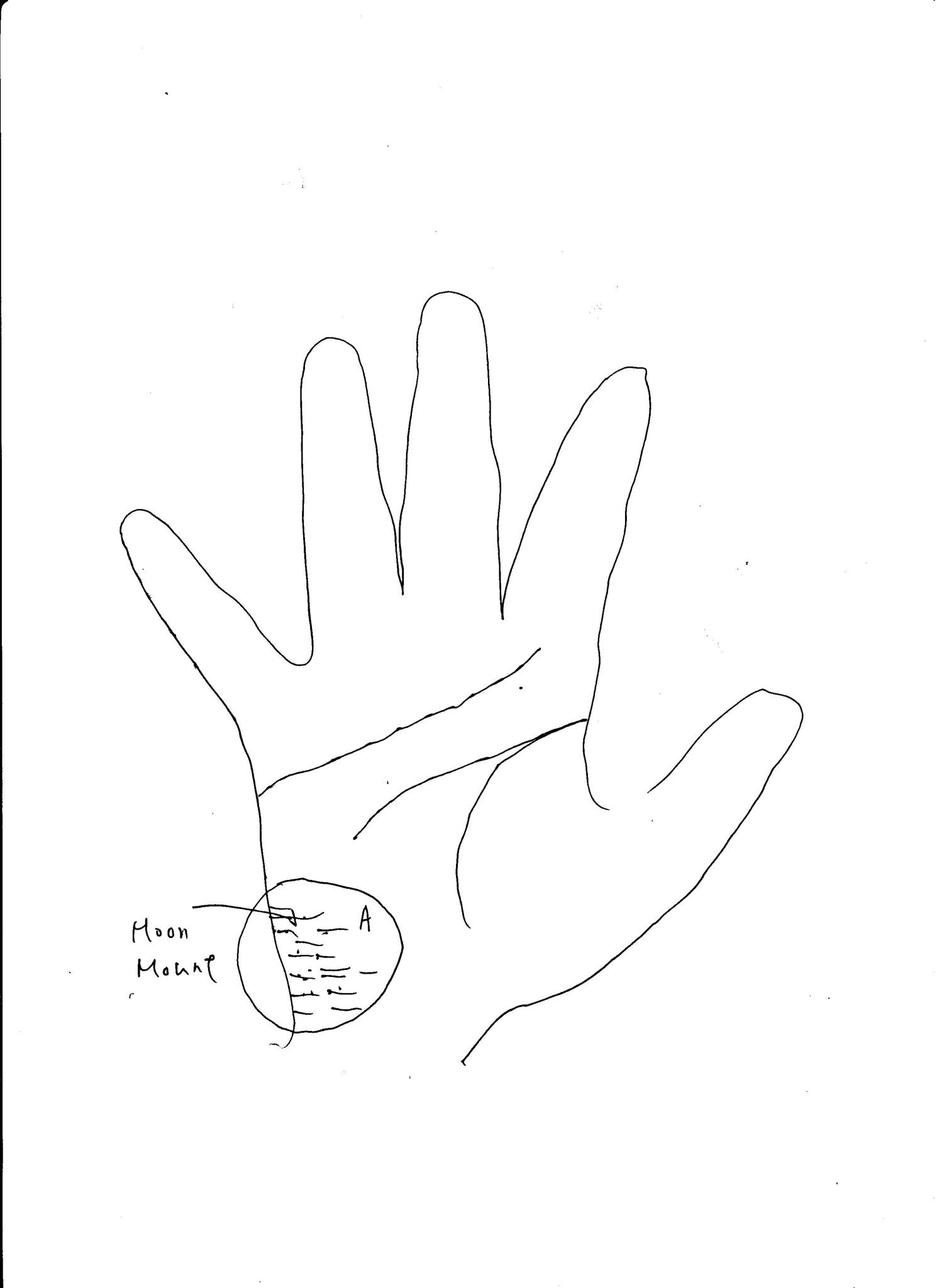 Where do the Signs of Liver Disease appear on the Palms of Your Hands ...